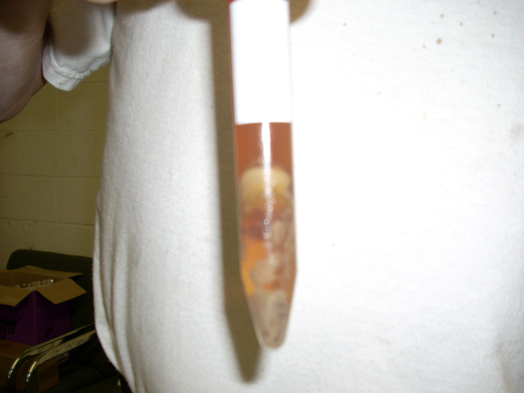 Buffalo Biodiesel Inc. , Biodiesel, Grease, Yellow Grease, Waste oil ...